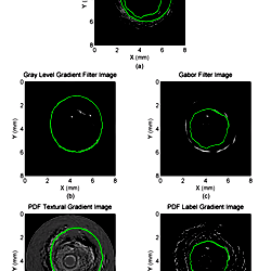 Example of an IVUS image and corresponding gradient images.