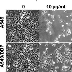 Cell morphology differences between A549 and A549/DDP cells.