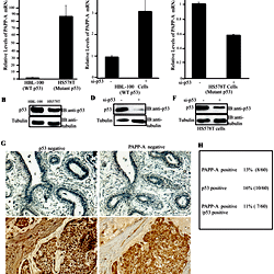 p53 regulates PAPP-A levels.