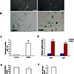 Inhibiting Nampt using FK866 increased cell senescence in MSCs obtained ...