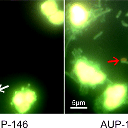 Microbial cell viability staining for infectious agents in AUP samples.