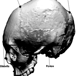 Cranial outline showing bregma and lambda and straight line demarcating ...