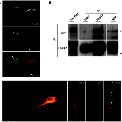 APP physically interacts with Hsp47 and affects its intracellular ...