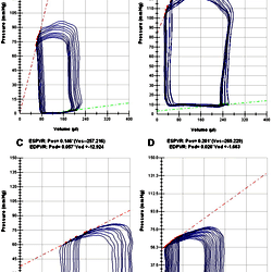 Representative pressure volume (PV) loops during preload reduction.