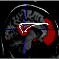 A paralimbic network of self-awareness.