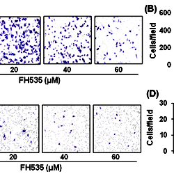 Effect of FH535, an inhibitor of β-catenin, on melanoma cell migration.