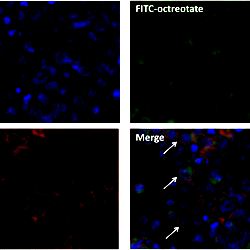 WB and WLB analysis.