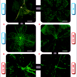 Analyses of Retinal Vascular Development in the Normal Retinal ...