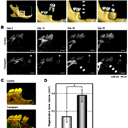Alveolar bone regeneration following the transplantation of a ...