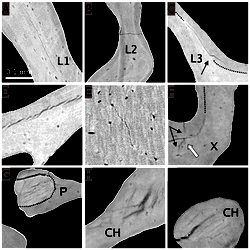 Illustration of various types of microcracks from 2D slices of SR micro ...