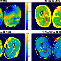 Representative example of B1 map and the three different T2 maps.