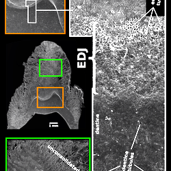 SEM images of selected tooth parts of a 17-month-old individual showing ...