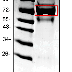 1-DE of the luminal fluid from the endolymphatic sac of controls.