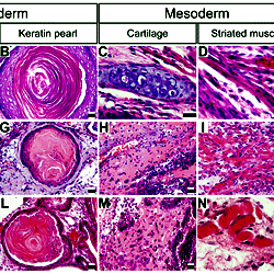 Identification of three germ layers in teratomas.
