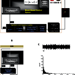 Schematic of the closed-loop DBS system.