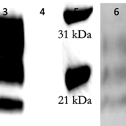 Western blot of a representative brain sample of each BSE strain and ...