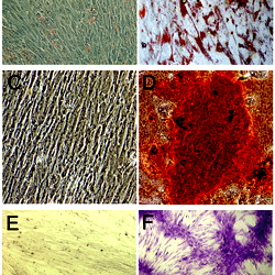 Differentiation of MSCs.