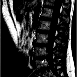 A representative MRI picture of the IVD samples.