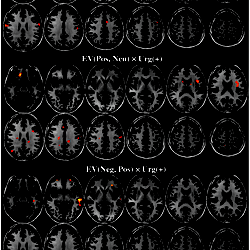 Whole-brain fMRI results for the interactions between EV and urgency.