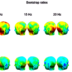 Bootstrap ratio maps for two PLS analyses comparing eyes-closed and ...