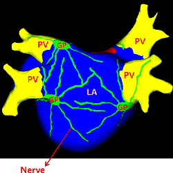 Model of GP and nerves based on the “octopus hypothesis” [6].