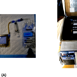 Cellular responses and gene expression profile changes due to bleomycin ...