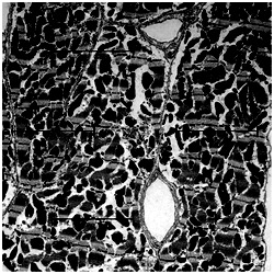 Demonstration of the point counting method.
