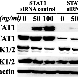 STAT1 and ERK1/2 pathways in A498 cells transfected with STAT1 siRNA by ...