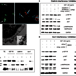 IGF1R internalization in TC71 cells by clathrin- and Cav1-dependent ...