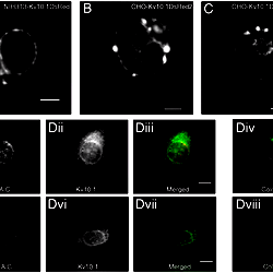 Examples of perinuclear localization of KV10.1.