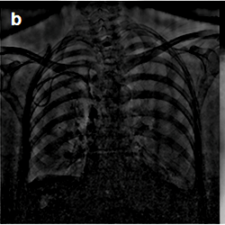 Conventional Radiography and DESR.