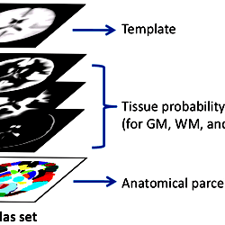 A sample atlas and its components.