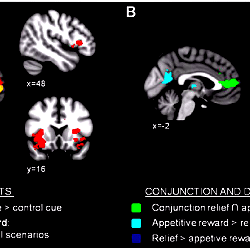Task-induced brain activation patterns.