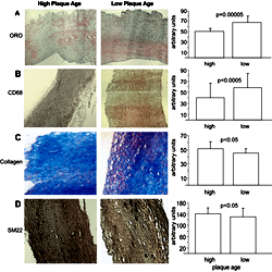 IHC characteristics of plaque age.