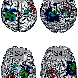 Relationship between the map of an intrinsic hand muscle (FDI) and ...
