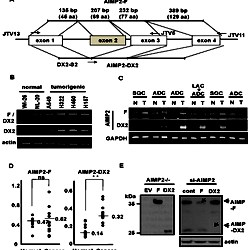 Generation of AIMP2 splicing variant lacking exon 2.