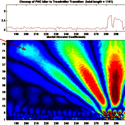 Shows a “close-up” of a PMN during a phase transition.