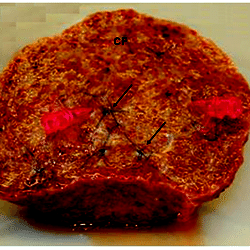 Preparation of the Encapsulated Liver Wedge Prior to Perfusion.