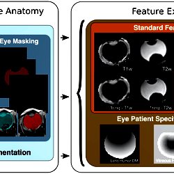 Proposed framework for automatic whole eye segmentation.