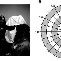 Tangent screen perimetry.