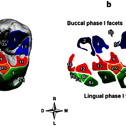 Occlusal wear pattern of first maxillary molars in Neanderthals.