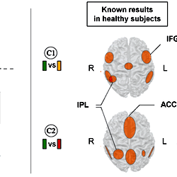 Diagram of the fMRI block-design with the expected results.