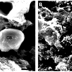 Scanning electron microscopy of a flame cell.