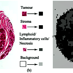 Supervised cell segmentation on (a) a H&E lung tissue core image, (b ...