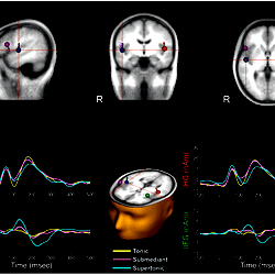 Locations and activities of multiple ECDs.