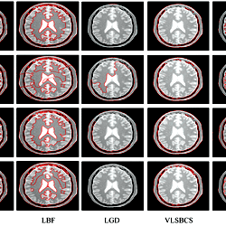 Effect of position of initial contour on the final segmentation results.