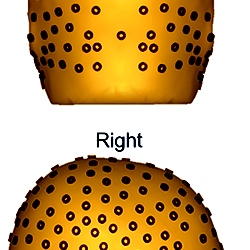 Geodesic Sensor Net 257-electrode array.