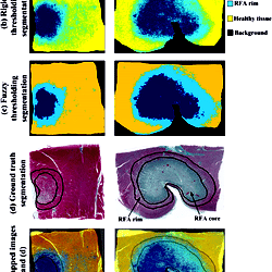Representative polarization images from two ablated myocardium samples ...