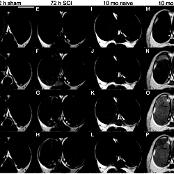Representative dynamic contrast-enhanced MRI testes images.