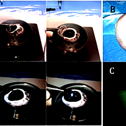 Open-sky and closed Pars Plana Vitrectomy (PPV) procedures in porcine ...
